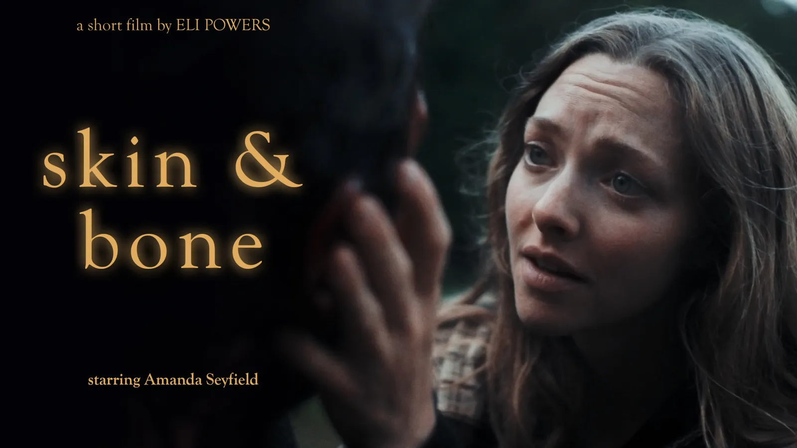 Watch & Download SKIN & BONE 2022 Full HD Movie Online | Xstream Play